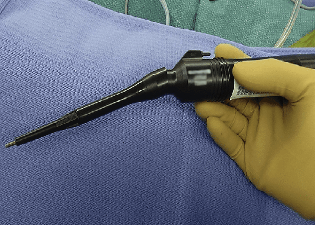 Ultrasonic Spine Treatment Options