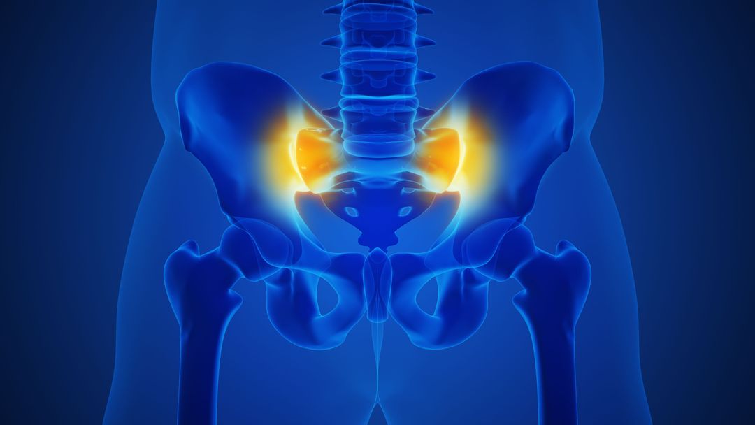 Sacroiliitis Treatment for SI Joint Pain