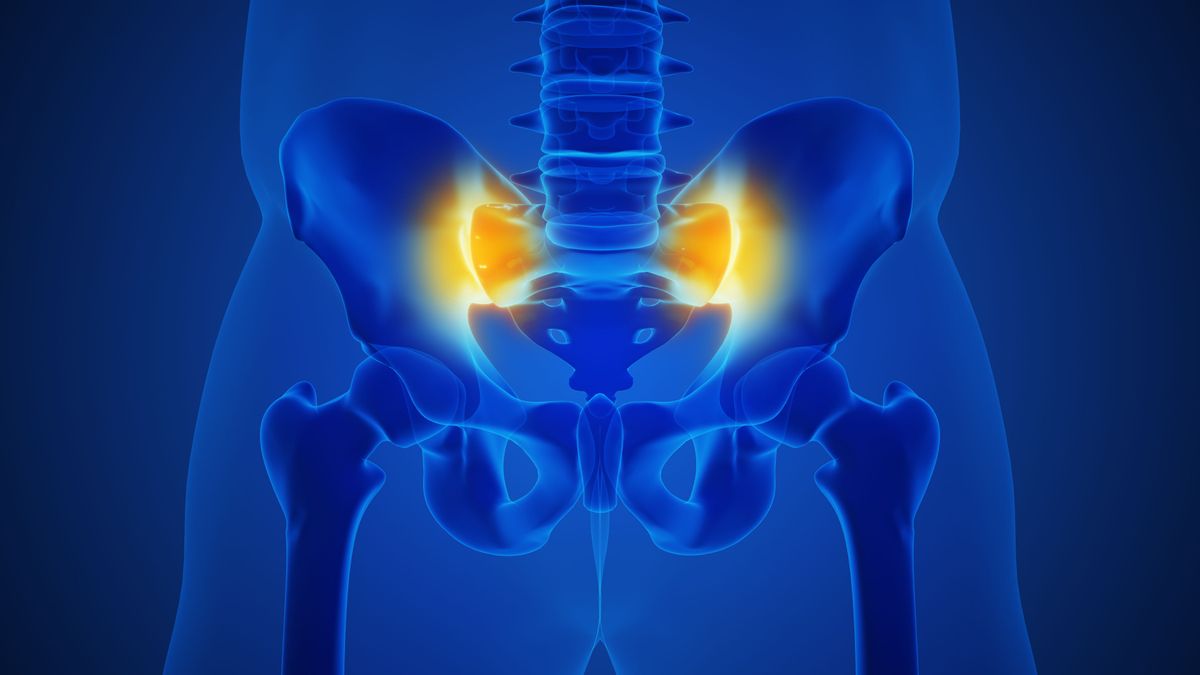 Sacroiliitis Treatment for SI Joint Pain