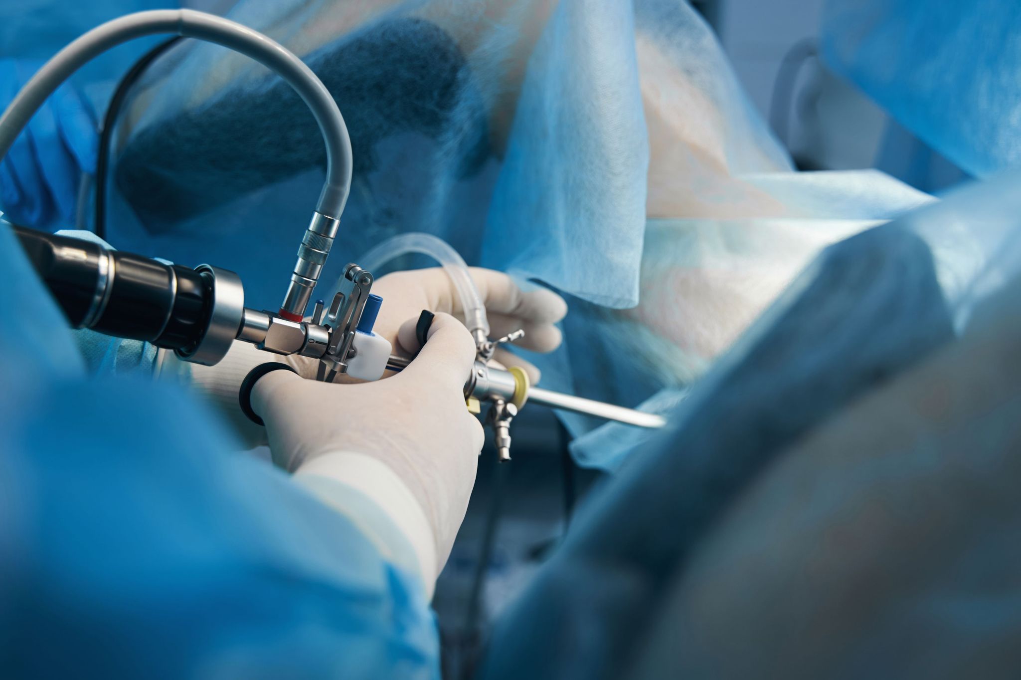 Laser Spine Surgery | Deuk Laser Disc Repair