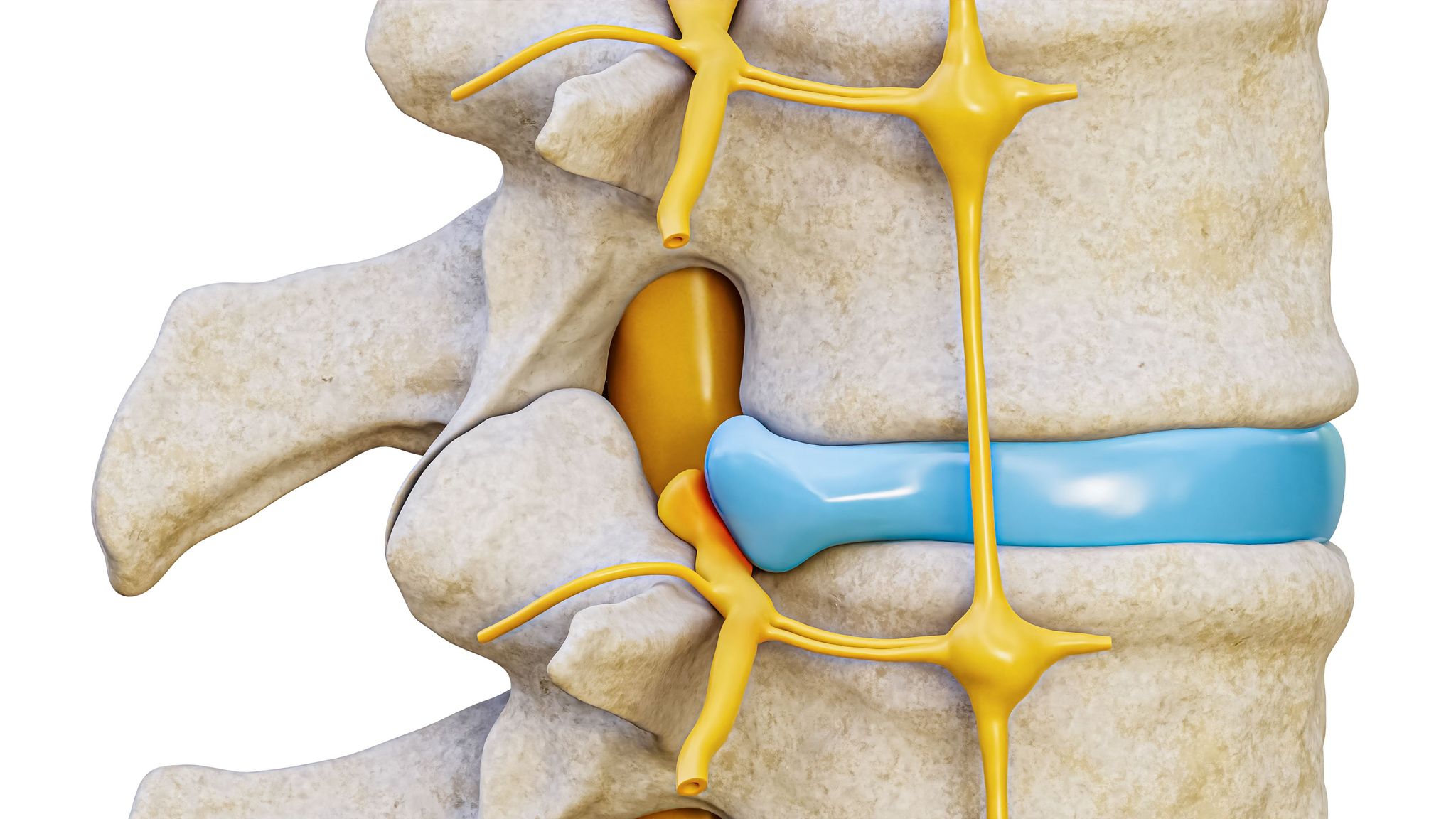 Discectomy Procedure Overview | Deuk Spine