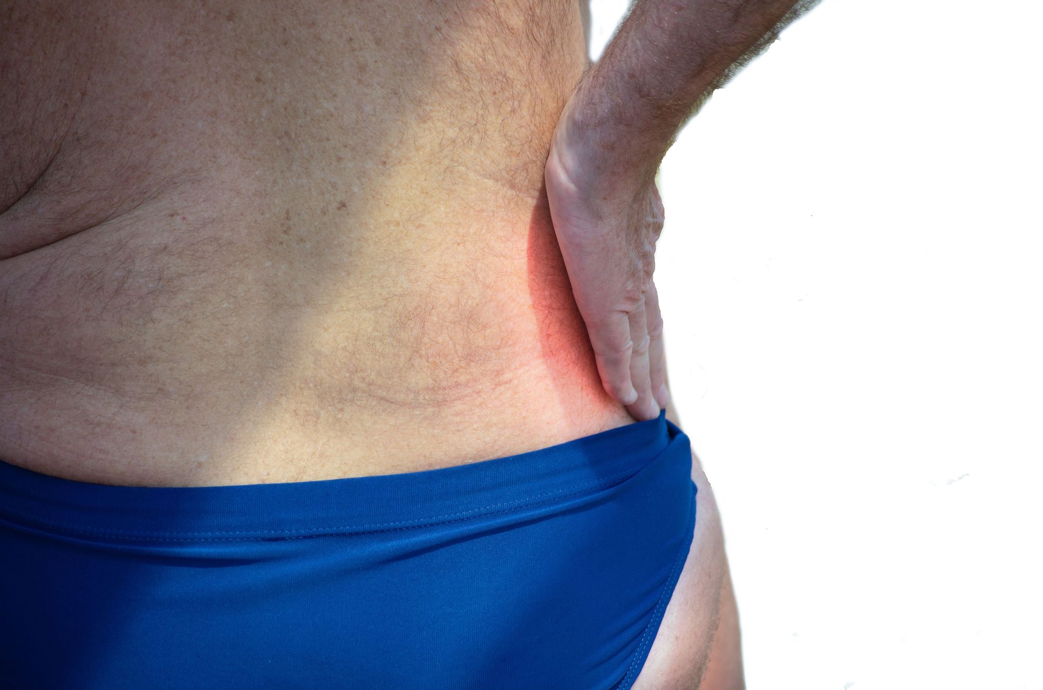Herniated Disc Hip Pain: Understand Symptoms And Treatments