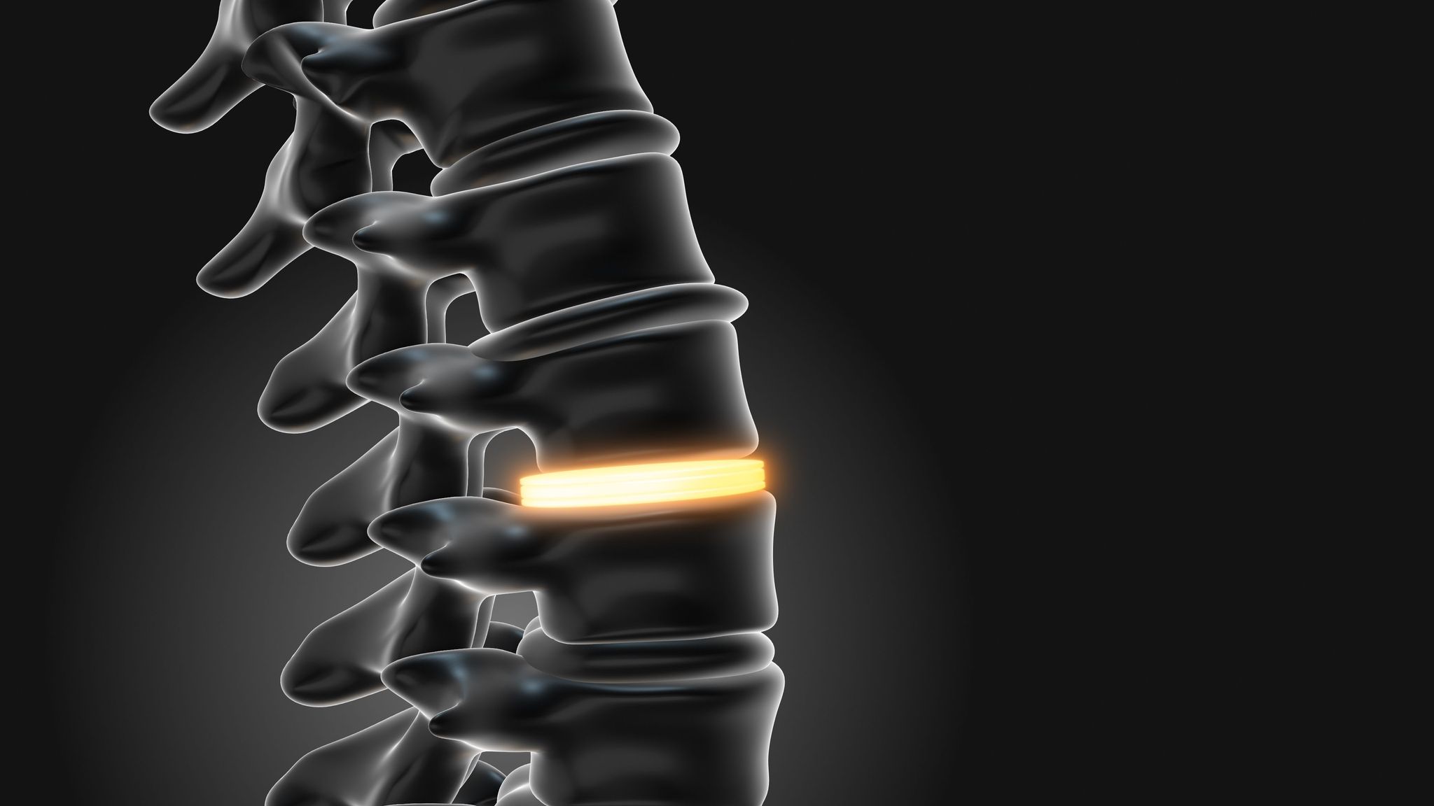 Intervertebral Disc Disease : Causes & Function