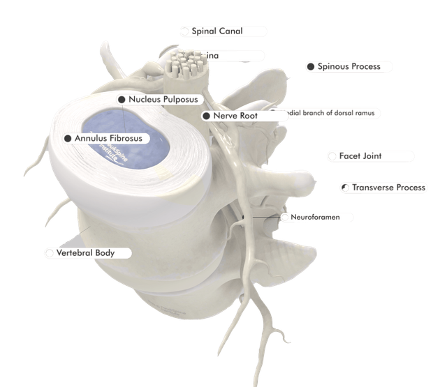 How a disc injury causes of chronic back pain