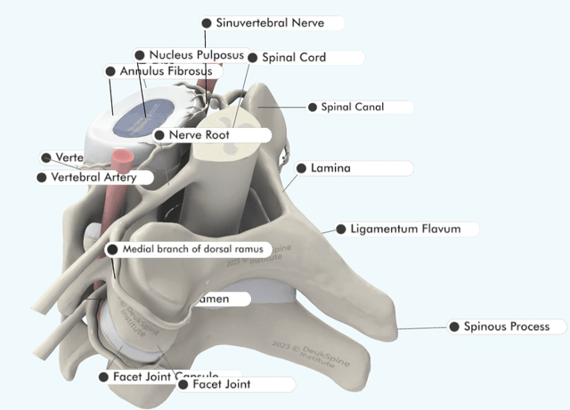 How a disc injury causes of chronic neck pain